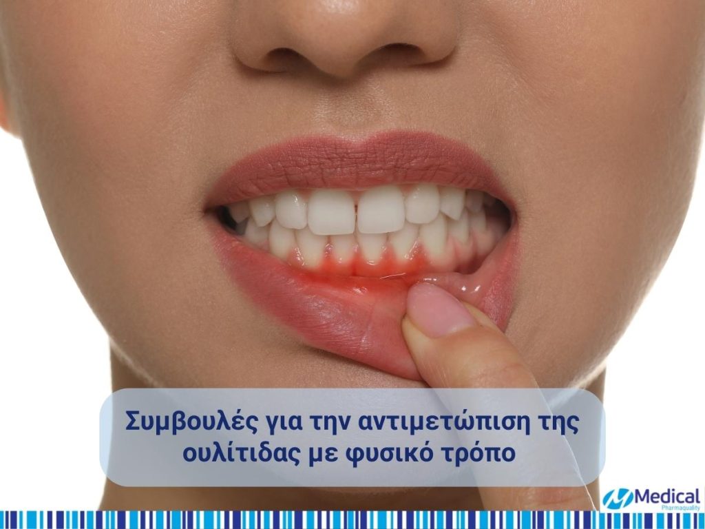 Συμβουλές για την αντιμετώπιση της ουλίτιδας με φυσικό τρόπο - Medical ...
